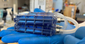 Artificial Kidney: How It Works and What the Future Holds