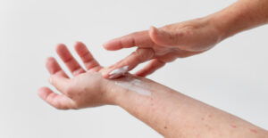 Capsaicin Cream for Neuropathy: Benefits, Uses, and Safety Guide